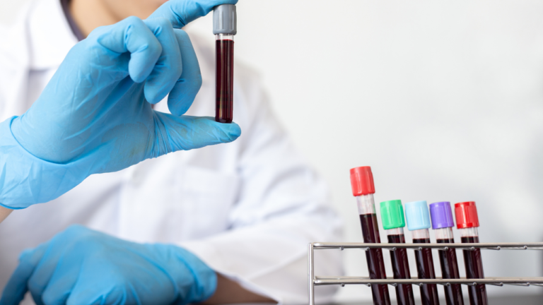 Calcium Deposits on Eyelids and Skin | Exercise Daily