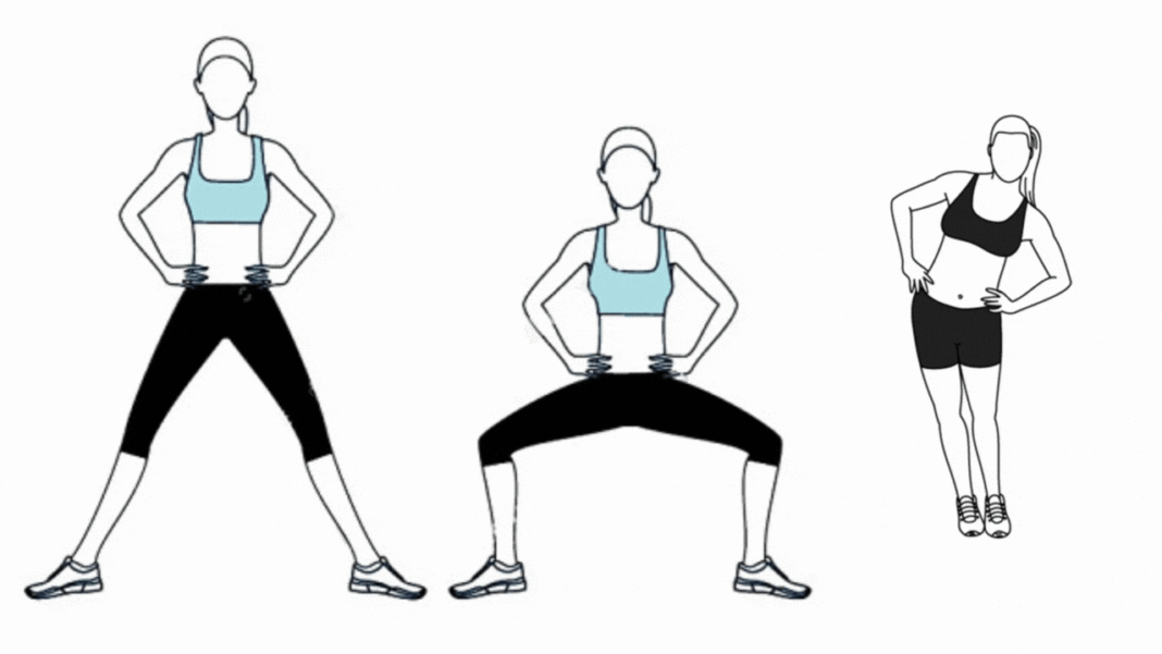 Snapping Hip Syndrome Exercises, Cases of Syndrome