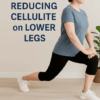 How to Get Rid of Cellulite on Lower Legs | Exercise, diet & lifestyle